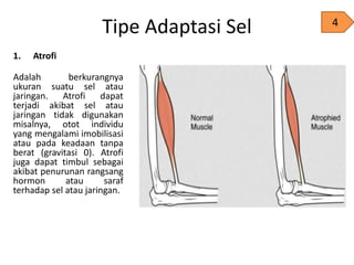 mata ajar patologi Adaptasi, Jejas dan Penuaan Sel.pptx
