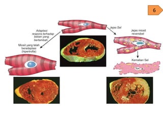 mata ajar patologi Adaptasi, Jejas dan Penuaan Sel.pptx