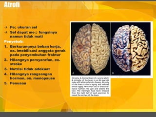 Adaptasi sel, jejas, penuaan sel.pptx