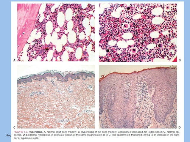 Adaptasi sel __jejas_sel__fkg | PPT