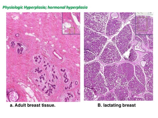 Adaptation 30. sept.2013