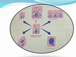 Adaptation of cellular growth and differentiation | PPT