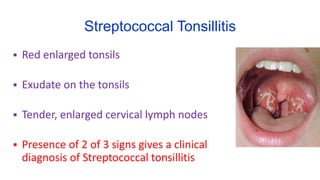 Adapted IMNCI throat problem 2020 | PDF