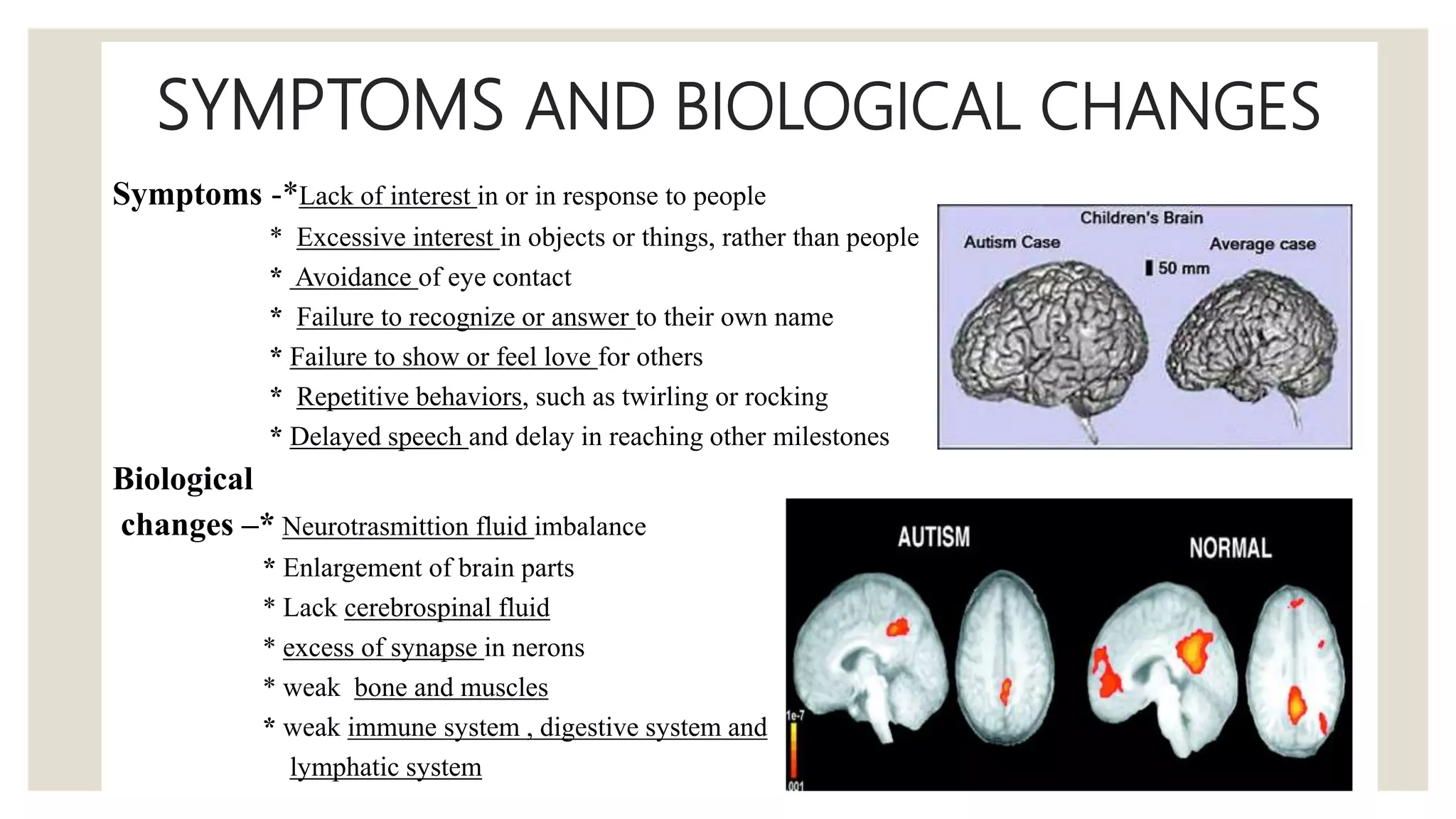 autism , in adapted physical education | PPTX