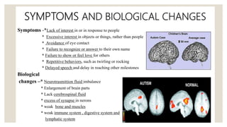 autism , in adapted physical education | PPTX