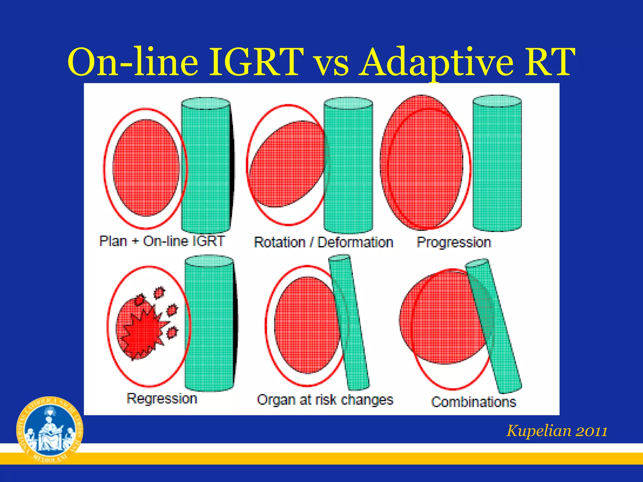 Adaptive radiotherapy | PPT