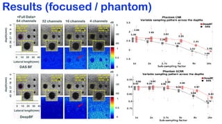 Adaptive and compressive beamforming using deep learning for medical ultrasound | PDF