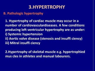 _ADAPTIVE DISORDER.pptx