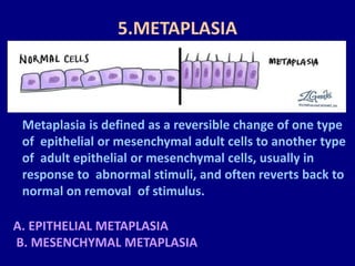 _ADAPTIVE DISORDER.pptx