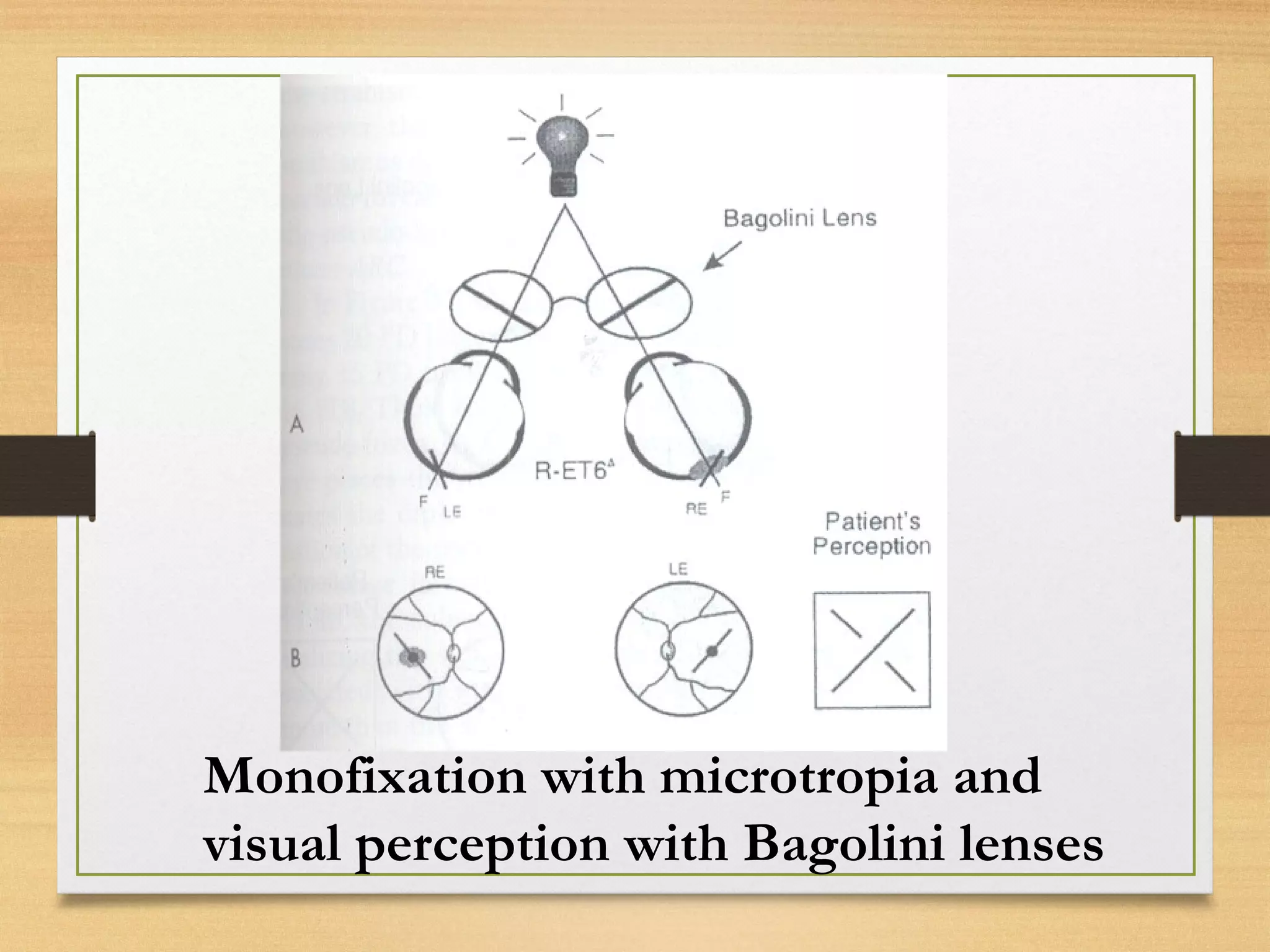 Adaptive mechanism of squint | PPT