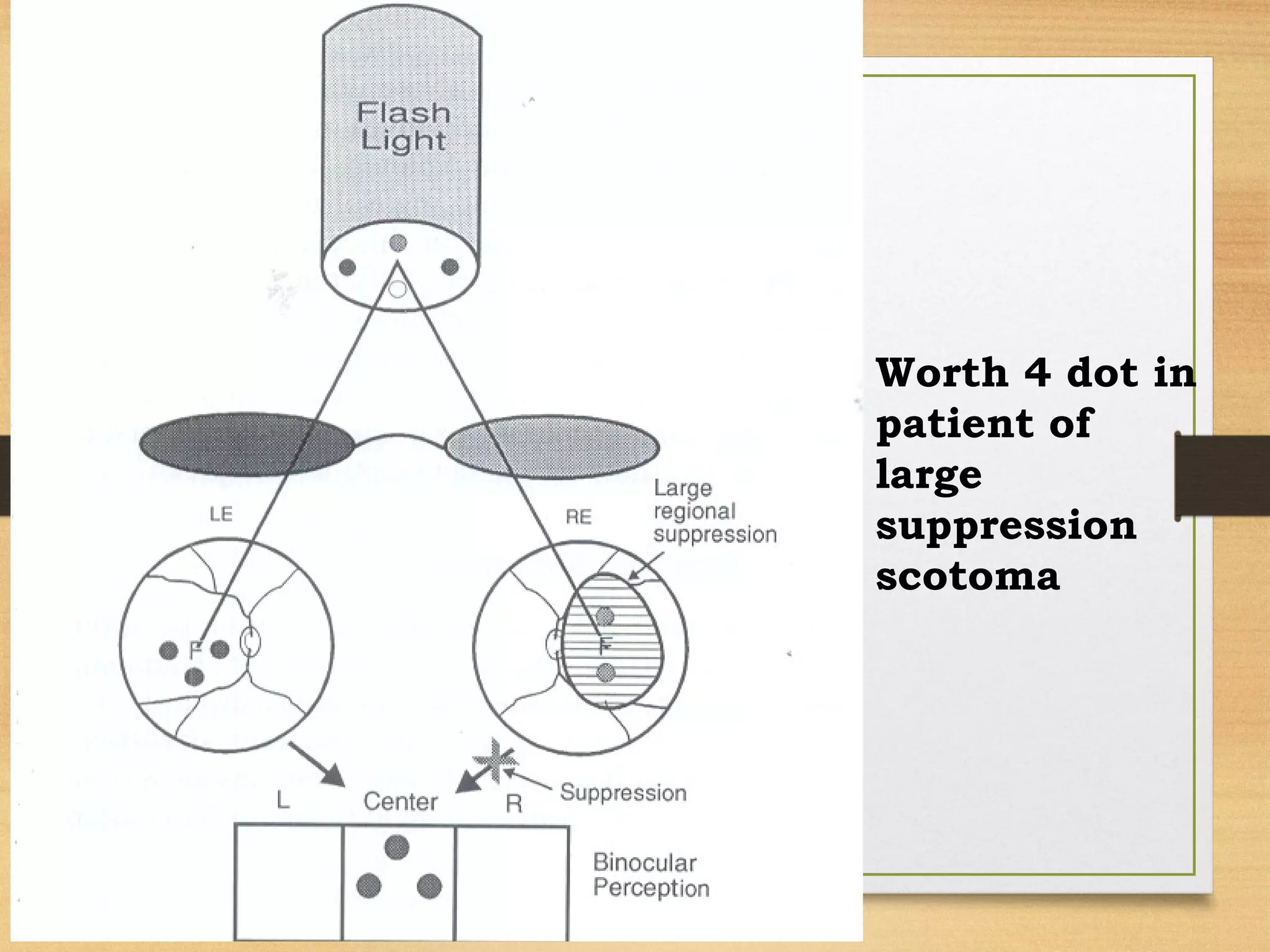 Adaptive mechanism of squint | PPT