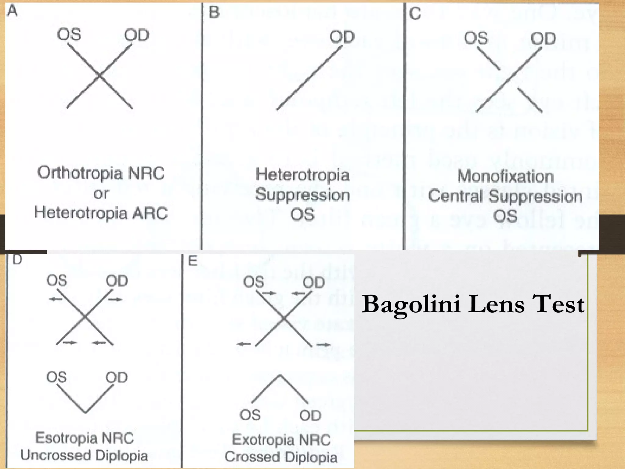 Adaptive mechanism of squint | PPT