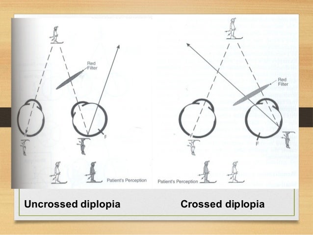 Adaptive mechanism of squint