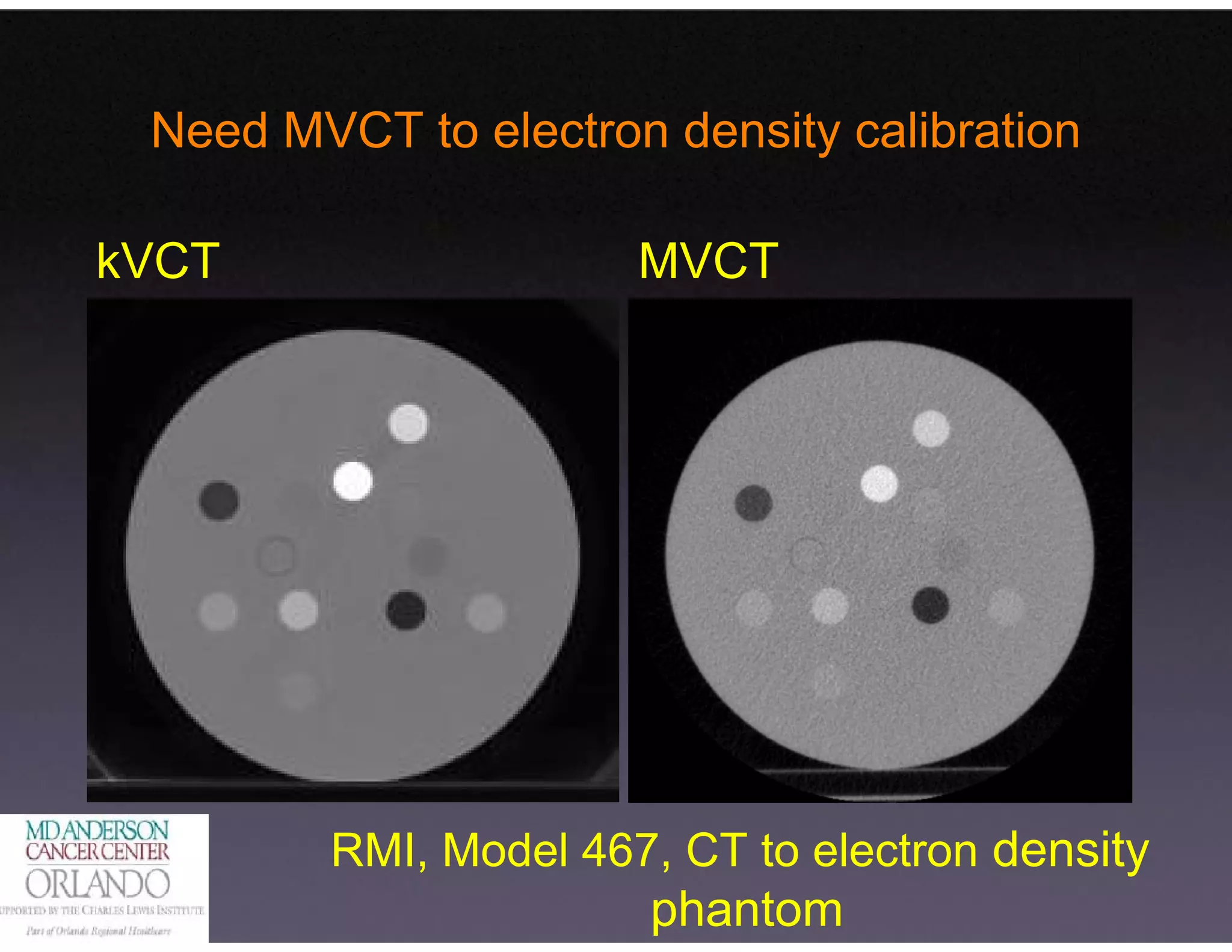 Adaptive Radiation Therapy With Tomo Therapy | PDF