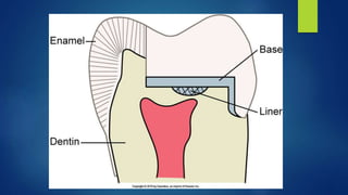 ADA Seal of Acceptance - Dental Cements- Key Terms, Uses | PPTX