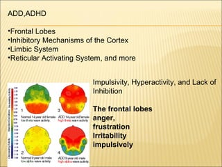 Add adhd cause cure | PPT