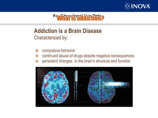 Addiction-and-the-Brain-Inova-Template_-002(1).pptx