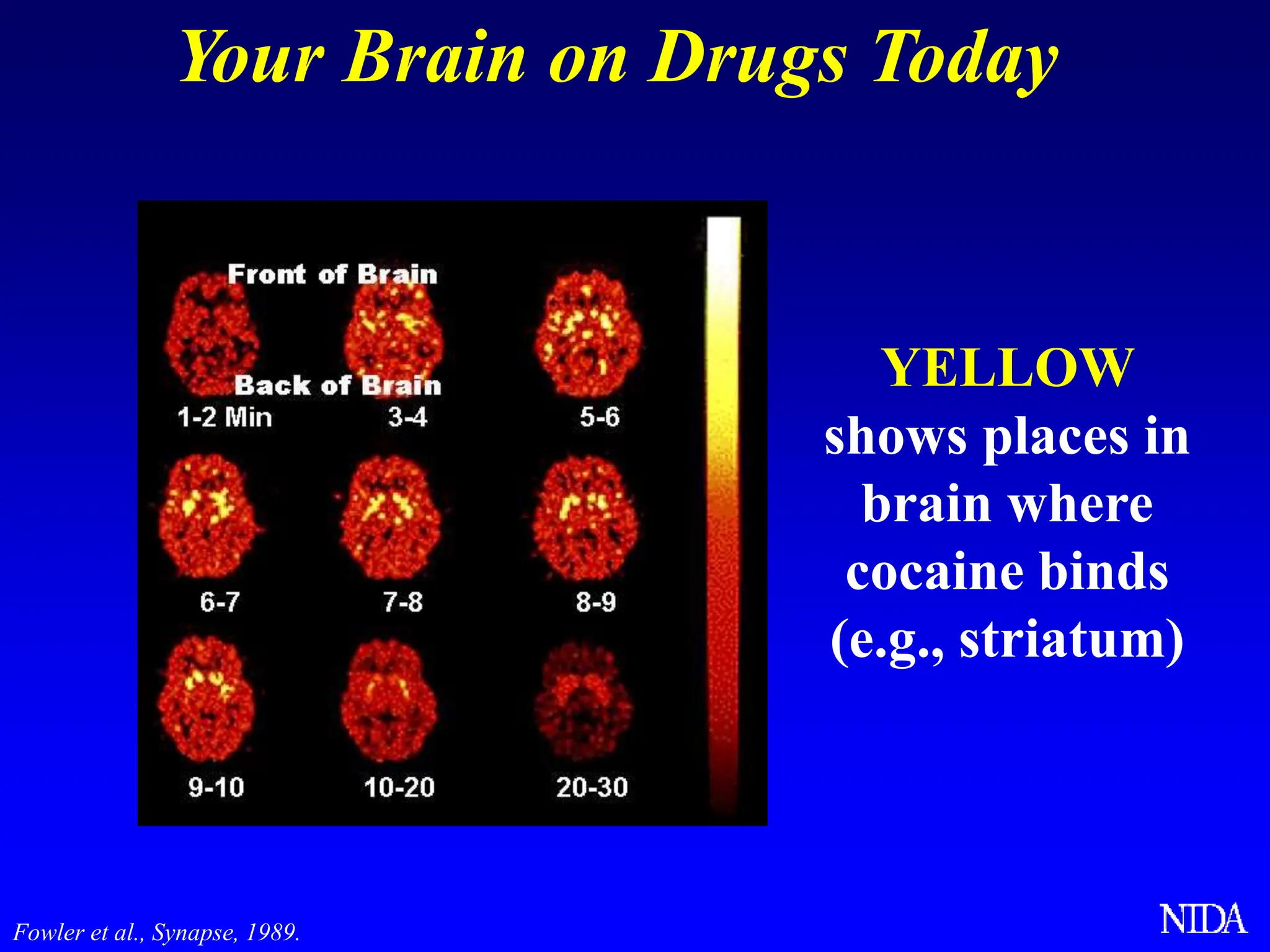 Neurobiology of drug abuse and addiction_NIDA | PPT