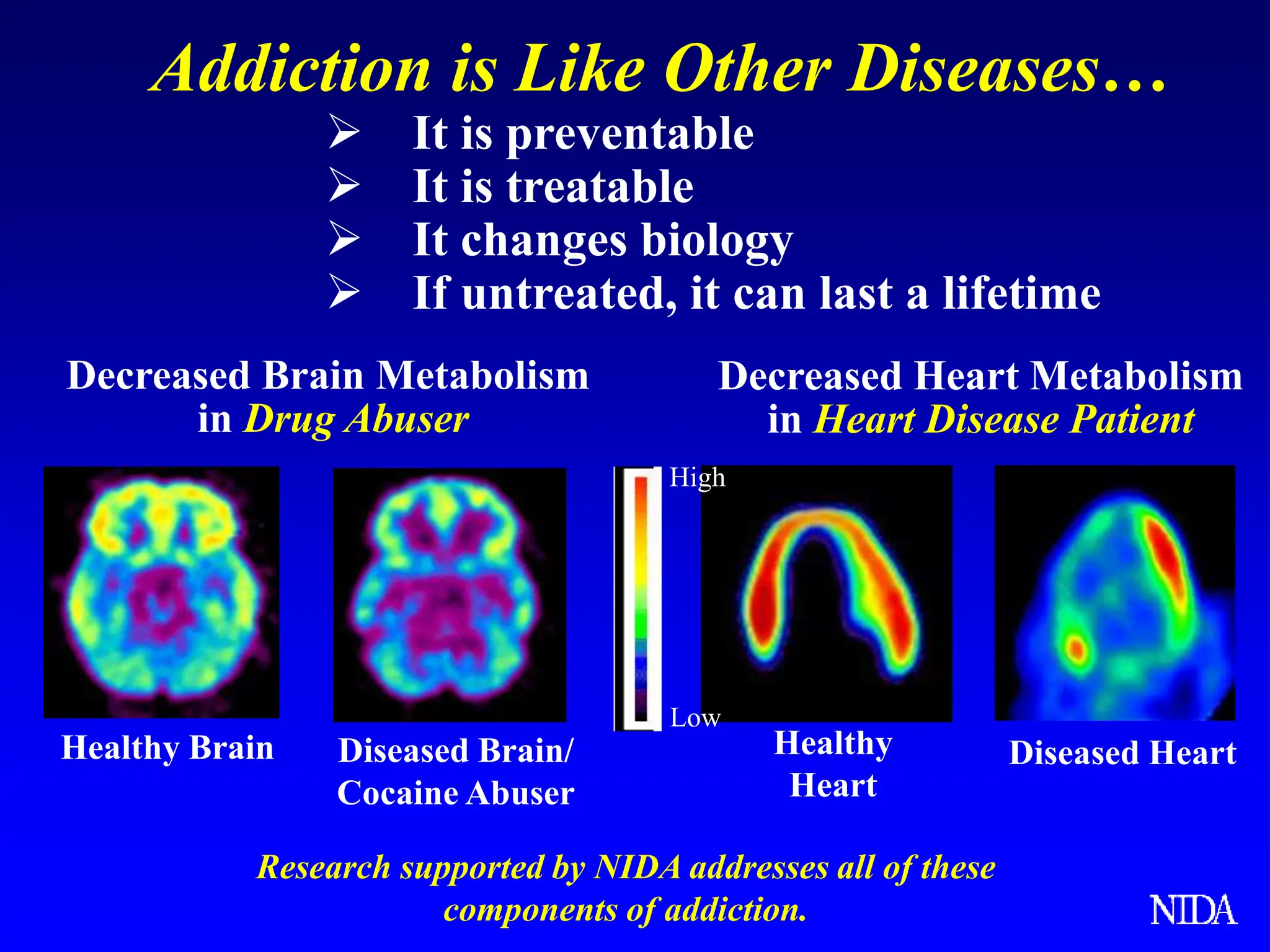 Neurobiology of drug abuse and addiction_NIDA | PPT
