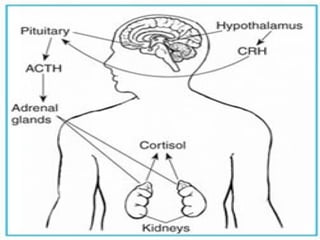 addison disease and its management adults.ppt