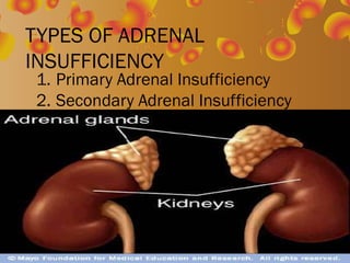 addison disease adults and its management.ppt