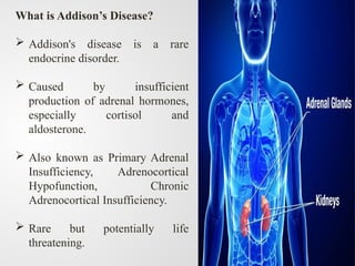 ADDISON DISEASES 9999.pptxPresentation Topic | PPTX