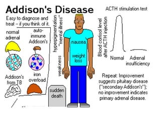 addisons and conn's.ppt