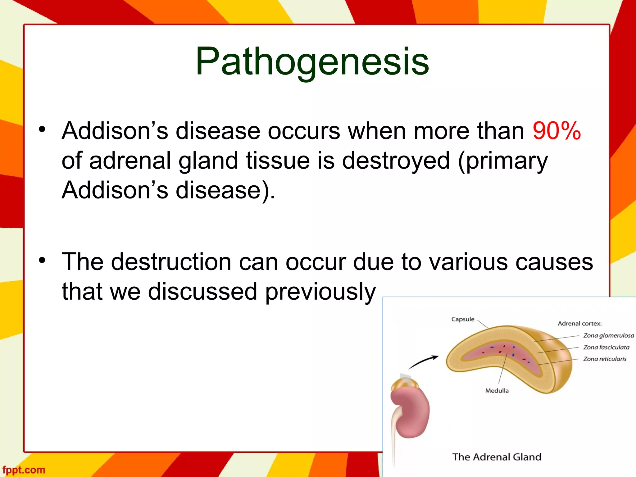 Addison's disease | PPT