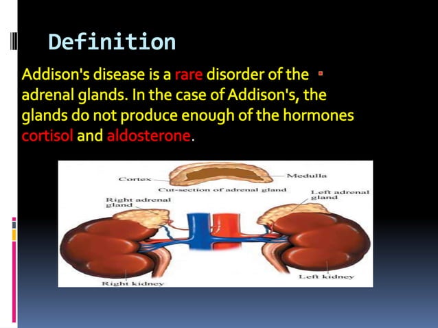 Addison’s disease | PPT