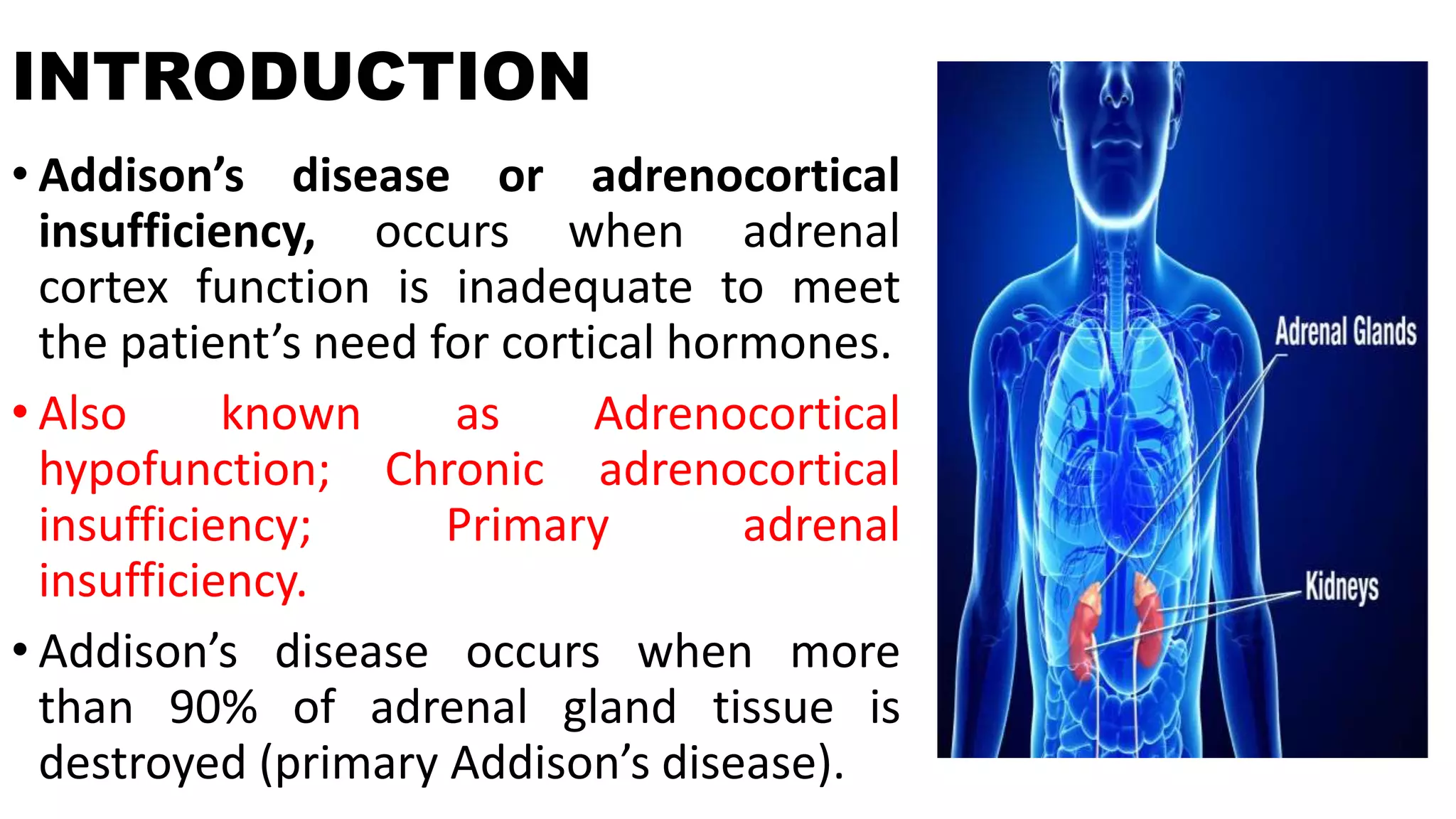 Addisons disease and its management | PPTX