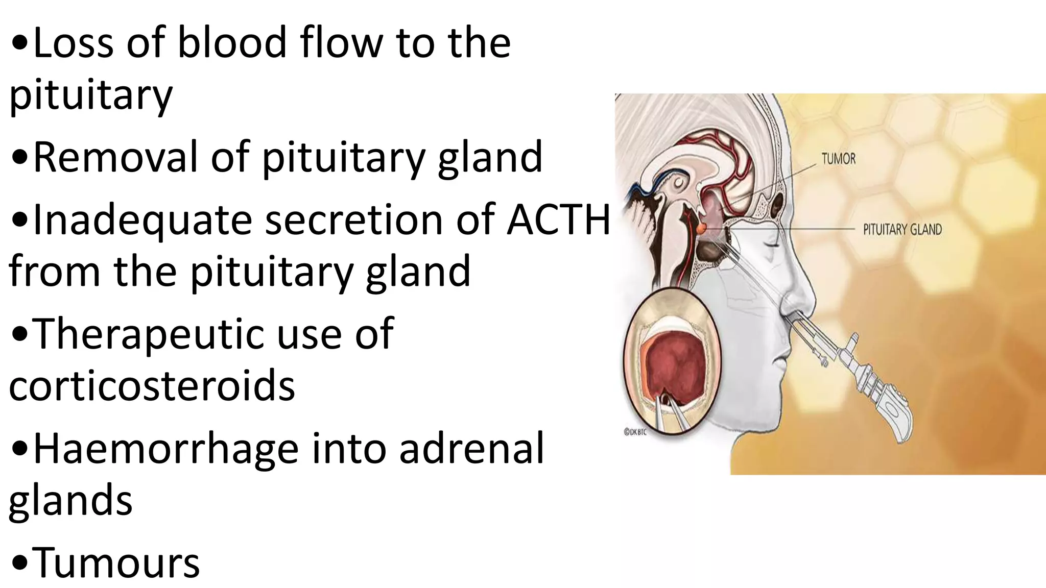 Addisons disease and its management | PPTX