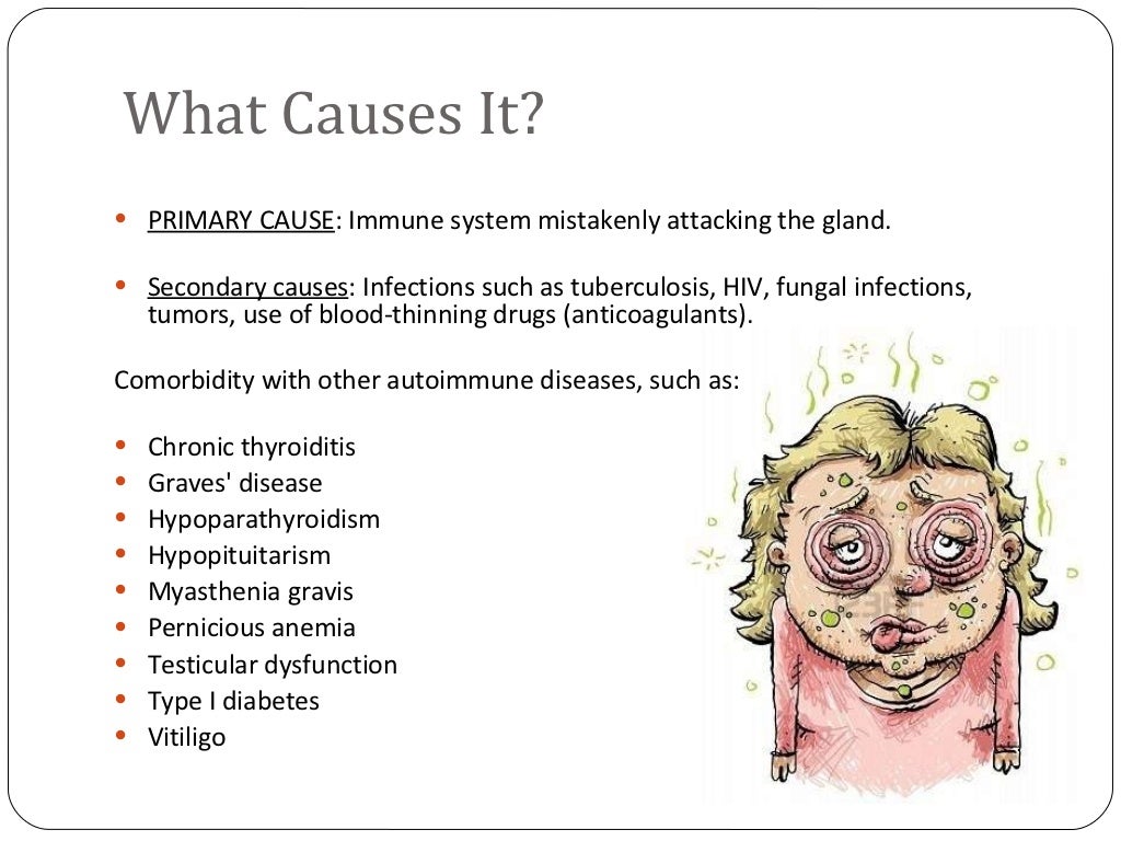 Addison's Disease