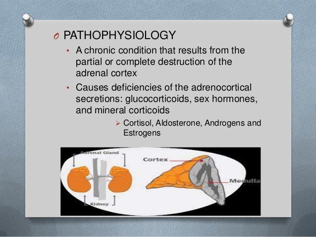 Addison Disease Histology