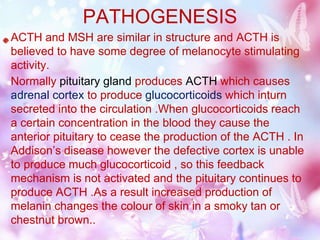 Addison’s disease important DR. Aijin.A.Mohan | PPT
