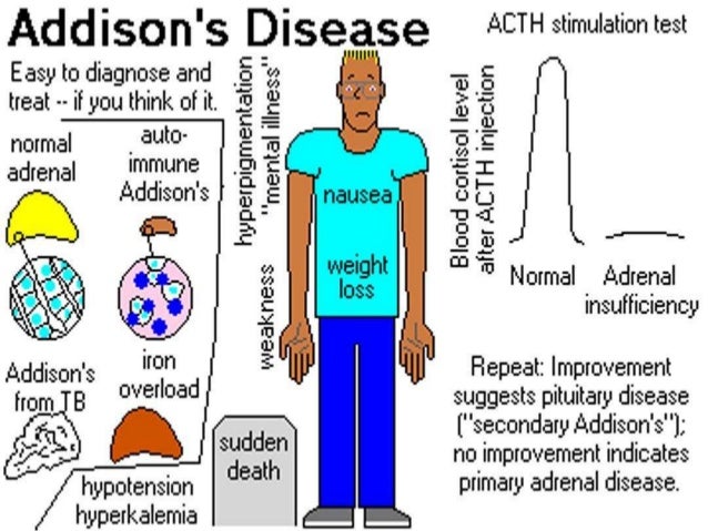Addison’s disease important DR. Aijin.A.Mohan