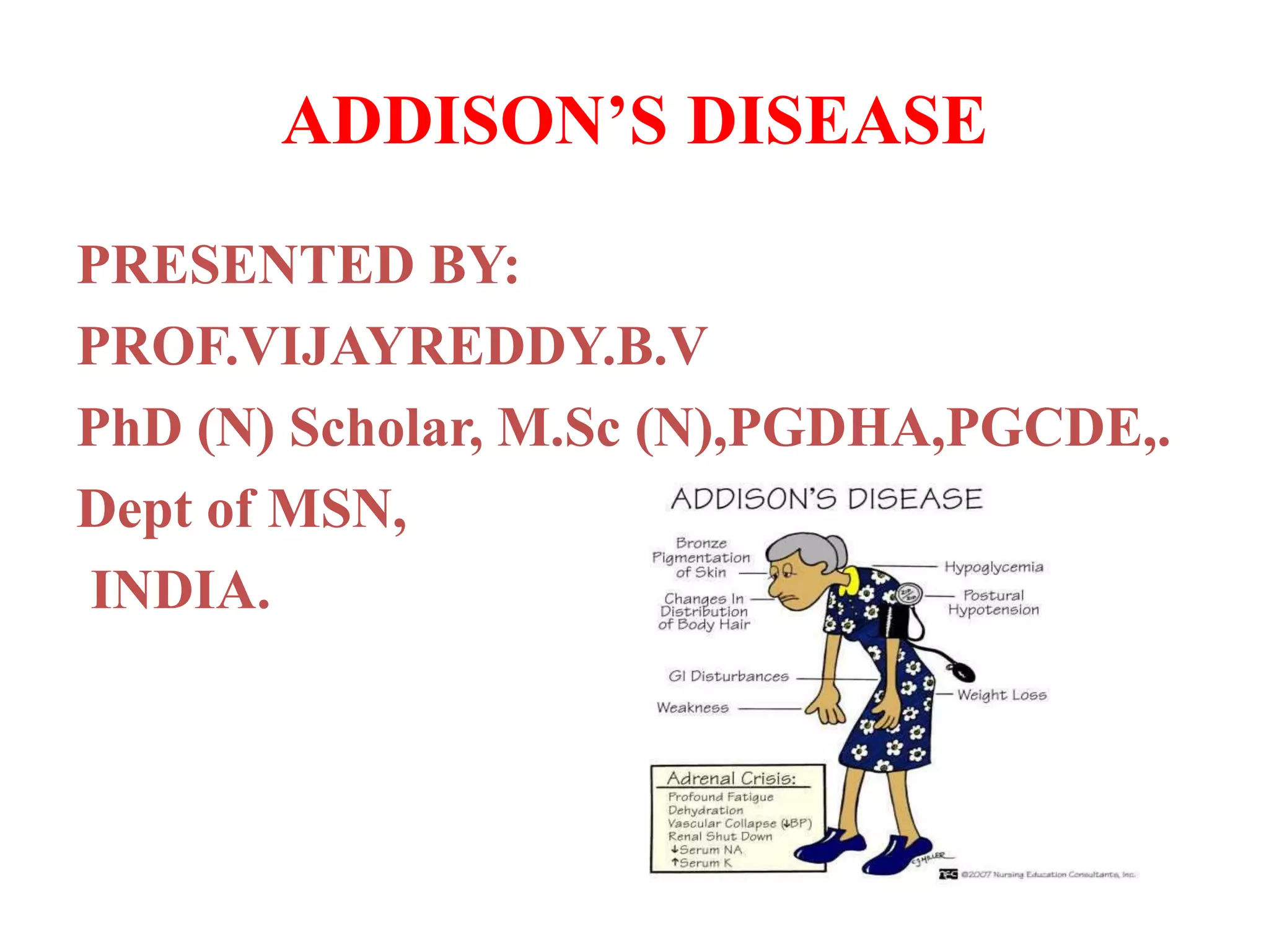 Addison's Disease ppt | PPTX