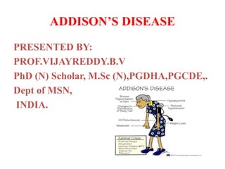Addison's Disease ppt | PPTX