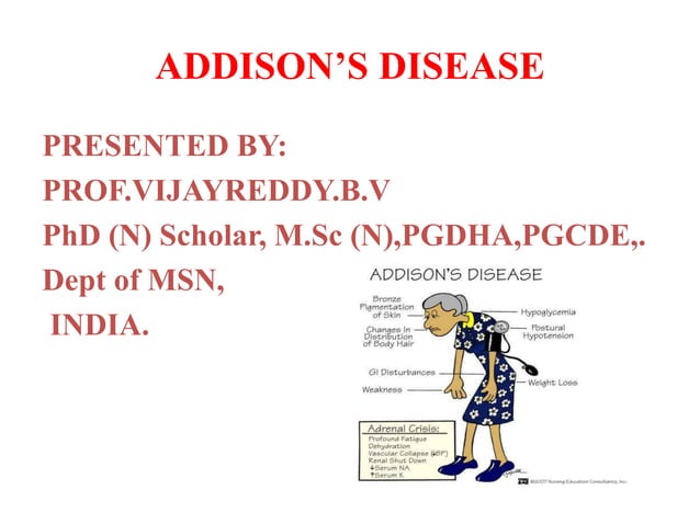 Addison's Disease ppt | PPTX