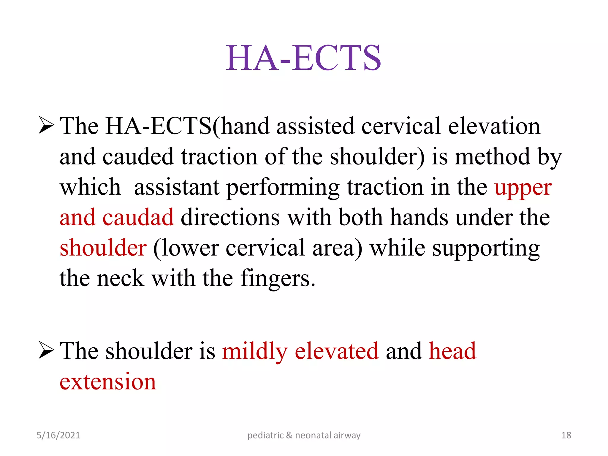 pediatrics airway anatomy | PPTX