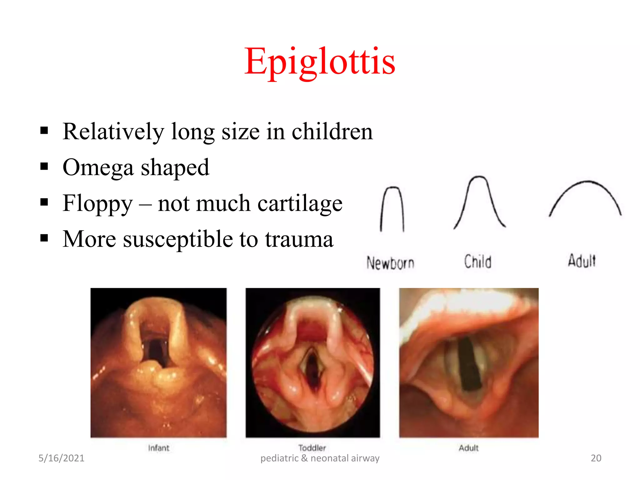 pediatrics airway anatomy | PPTX