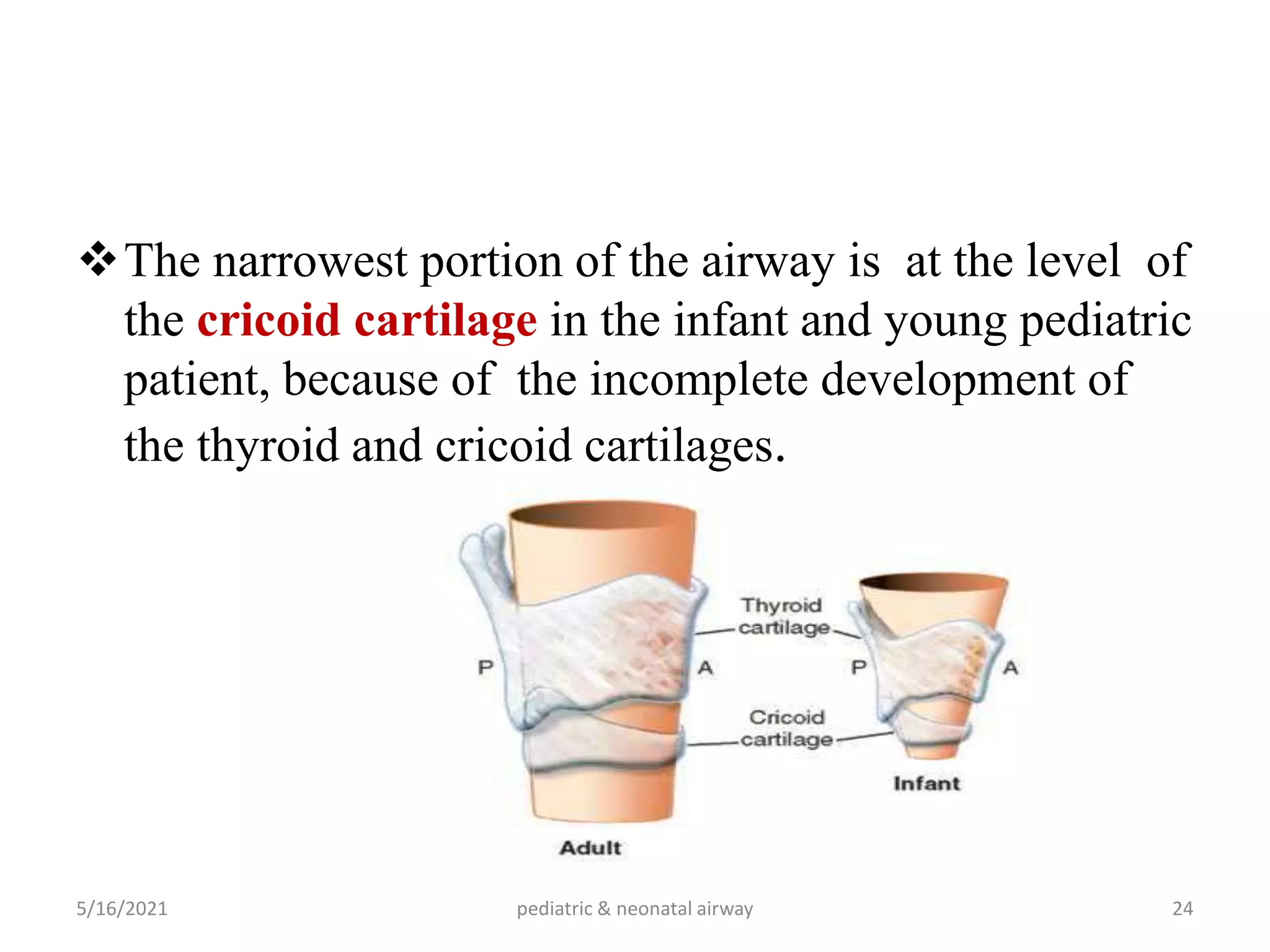 pediatrics airway anatomy | PPTX