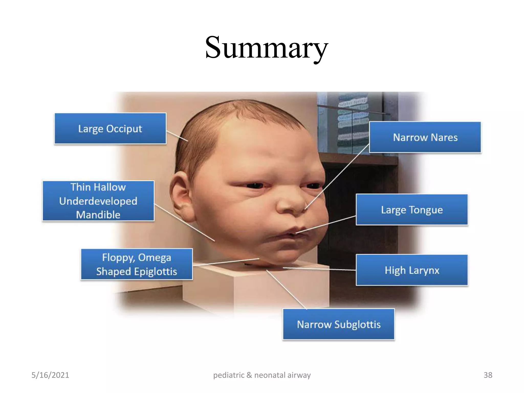 pediatrics airway anatomy | PPTX