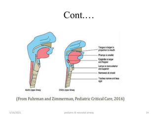 pediatrics airway anatomy | PPTX