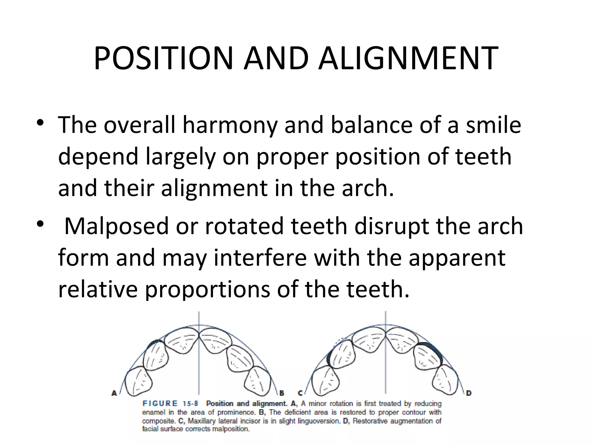 Additional conservative and esthetic procedures | PPT