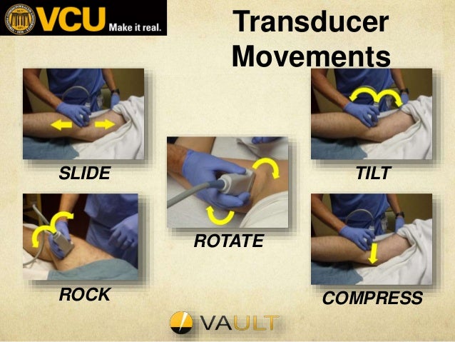 Addition of ultrasound