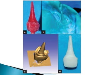 Additive manufacturing in dentistry | PPTX