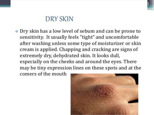 Addressing to dry skin and acne | PPT