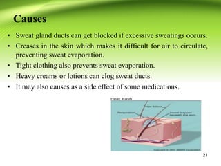 Addressing to pigmentation, prickly heat, wrinkles | PPTX