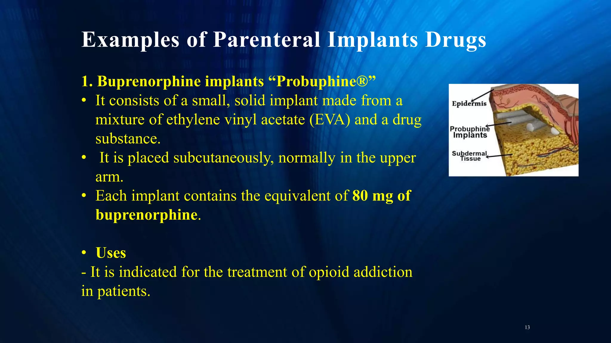 Parental Implants | PPTX