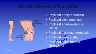 Anatomy of the Adductor Canal and popliteal fossa.pptx
